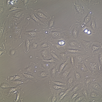 HUVEC Primary Cells