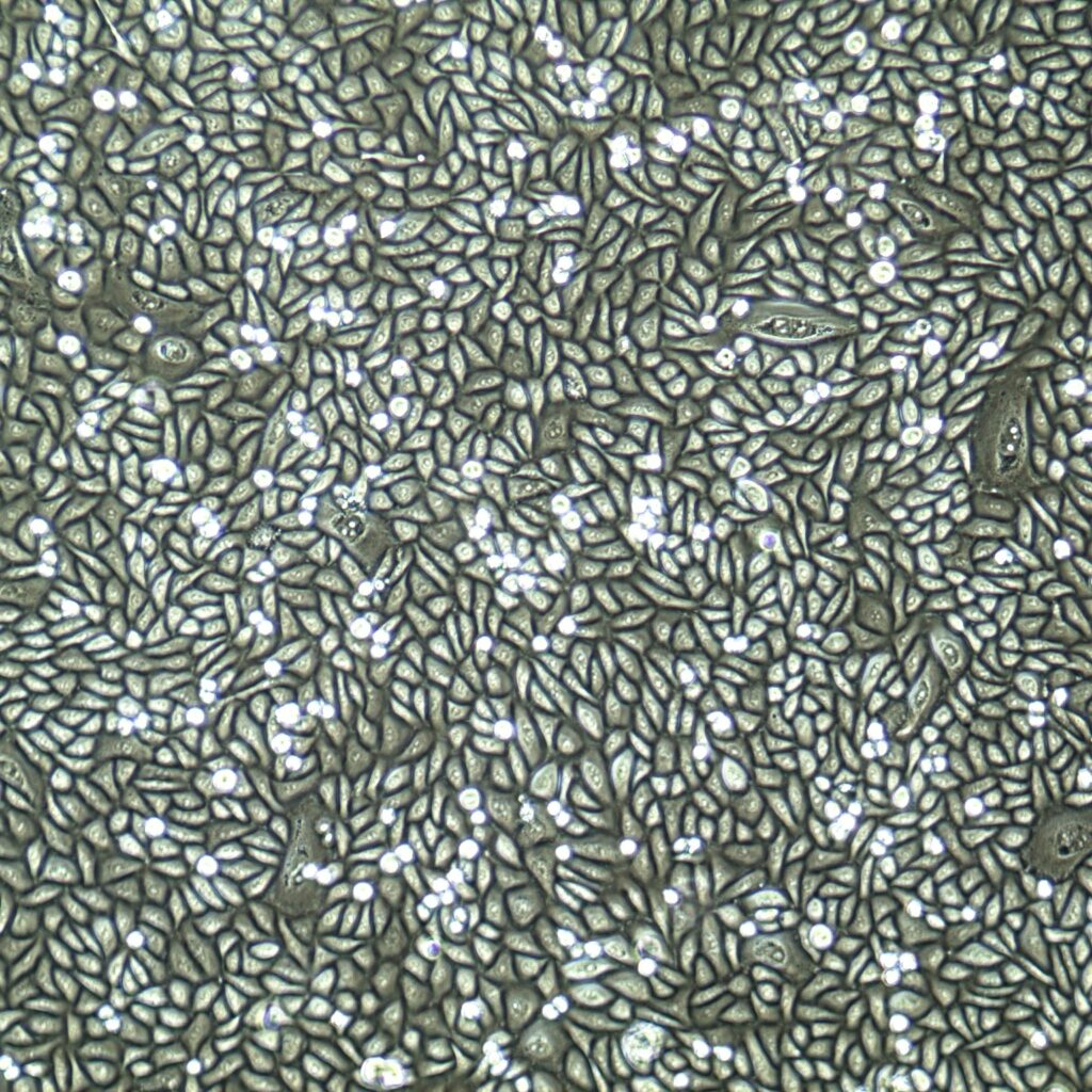 Human Primary Skin Cells for Cell Culture