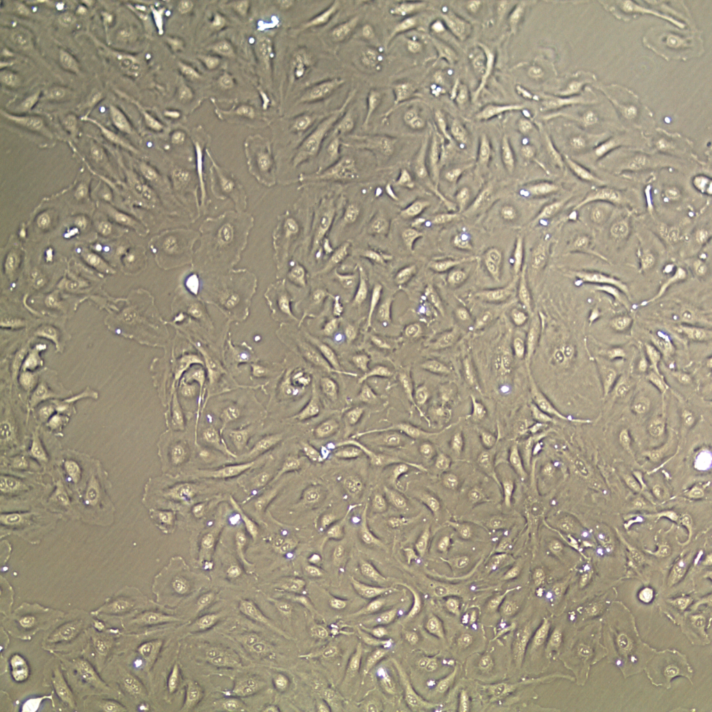 Human Primary Endothelial Cells