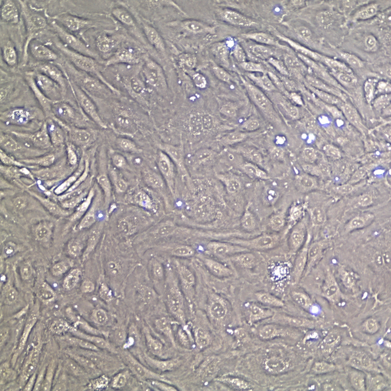Primary Human Aortic Endothelial Cells