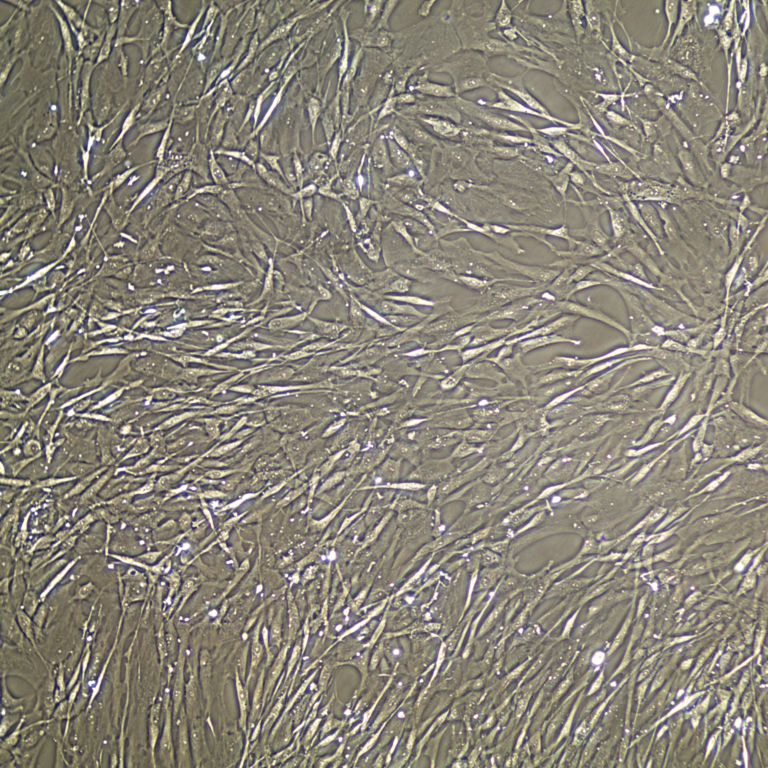 Primary Smooth Muscle Cells
