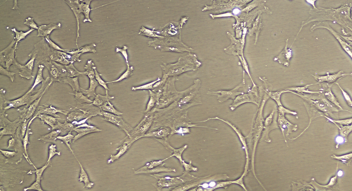 Human Smooth Muscle Cells Research