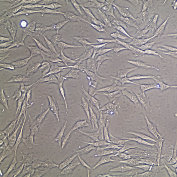 Human Dermal Fibroblasts Adult Primary Cells