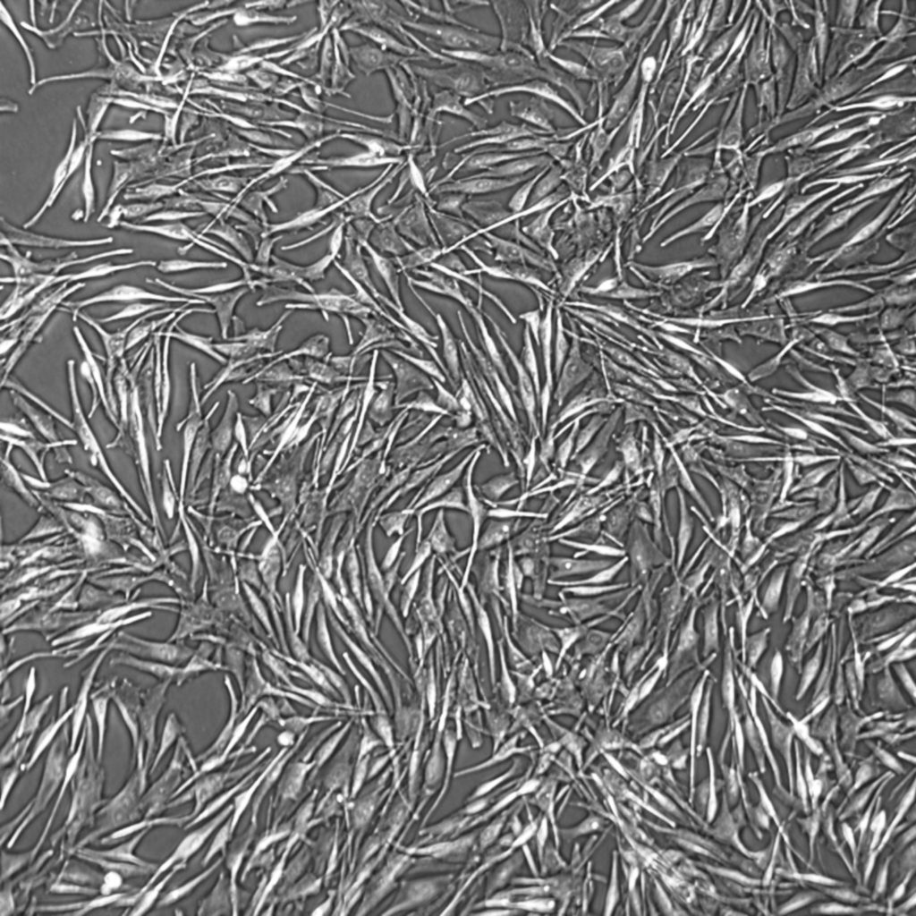 Primary Human Cells and Optimized Media