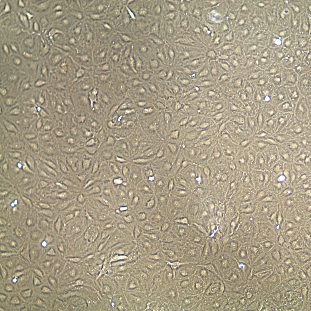 Human Neonatal Dermal Microvascular Endothelial Cells