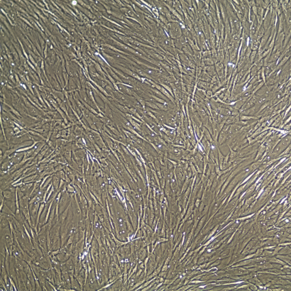 Primary Smooth Muscle Cells