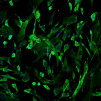 Primary Human Bladder Smooth Muscle Cells