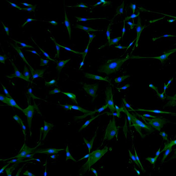 Human Lung Smooth Muscle Cells
