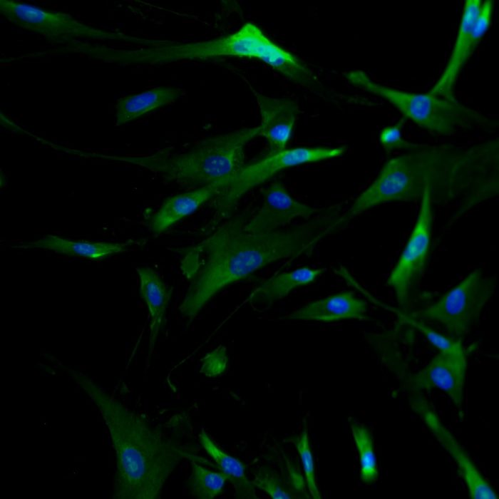 Human Lung Smooth Muscle Cells