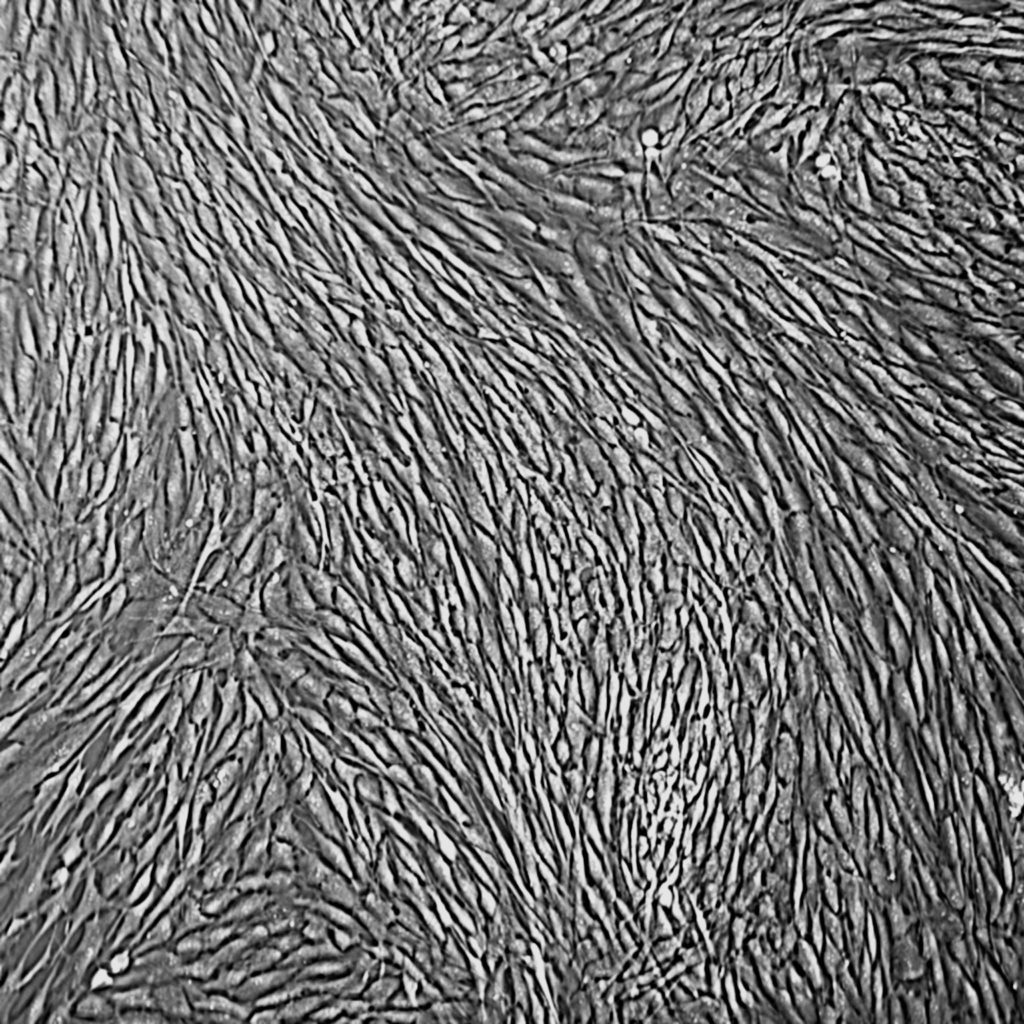 Primary Human Fibroblasts