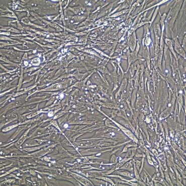 Primary Smooth Muscle Cells