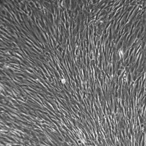 Airway Primary Smooth Muscle Cells