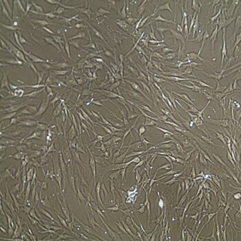Primary Human PreAdipocytes