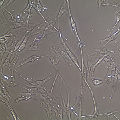 Whartons Jelly Human Mesenchymal Stem Cells