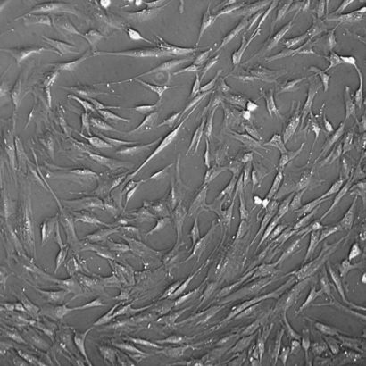 Primary Human PreAdipocytes