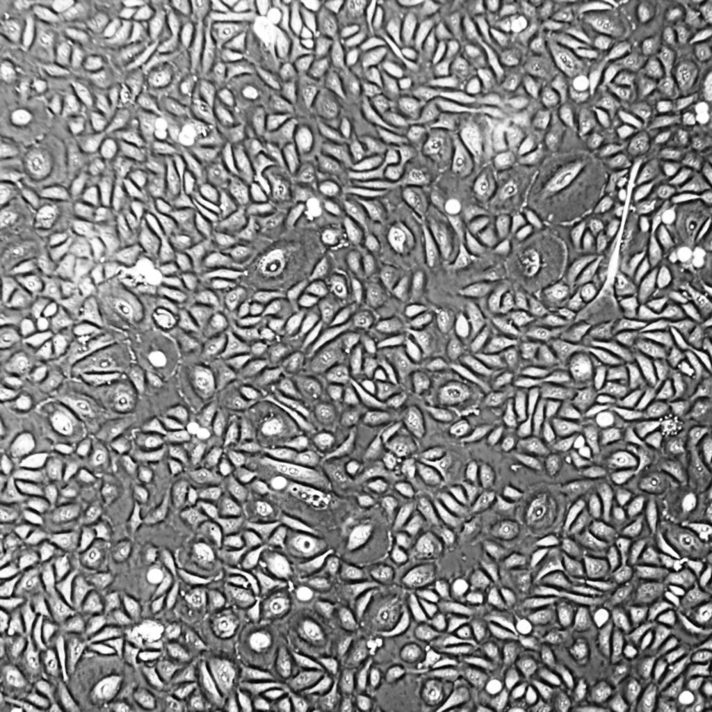 Primary Human Bladder Apex Epithelial Cells