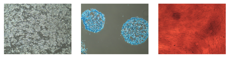 Bone Marrow Mesenchymal Stem Cell Medium