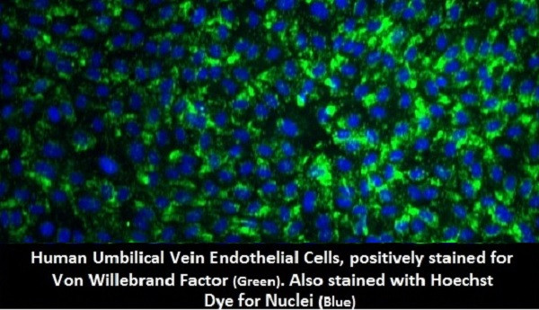Using Endothelial Cells and HUVECs in Research