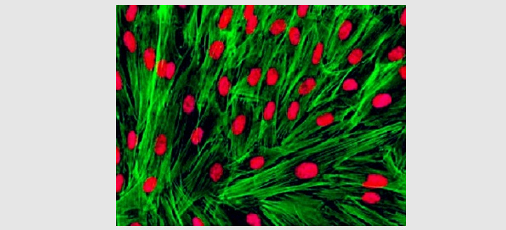 Human Fibroblasts Latest Research