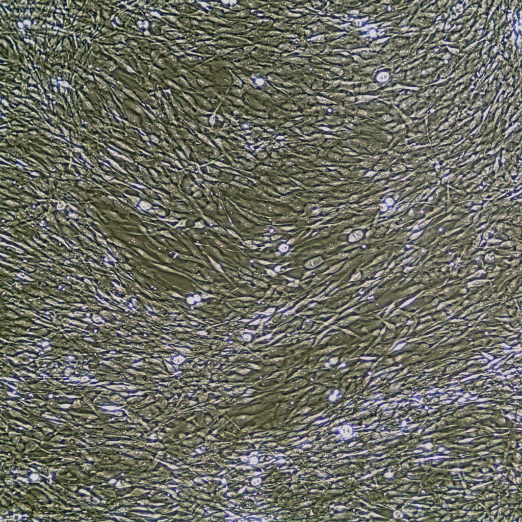 Primary Human Fibroblasts