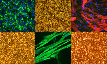 Lifeline Cells and Media Used in 2018 Research