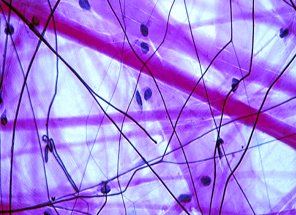 Human Fibroblasts in Decompression Sickness Research