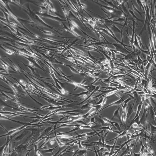 Primary Smooth Muscle Cells