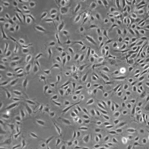 Human Primary Endothelial Cells