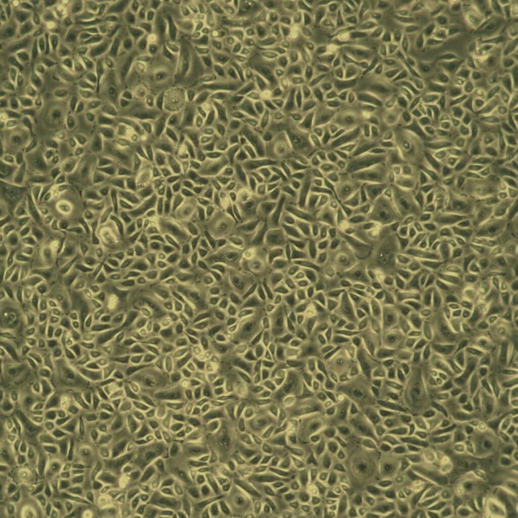 Human Small Airway Epithelial Cells