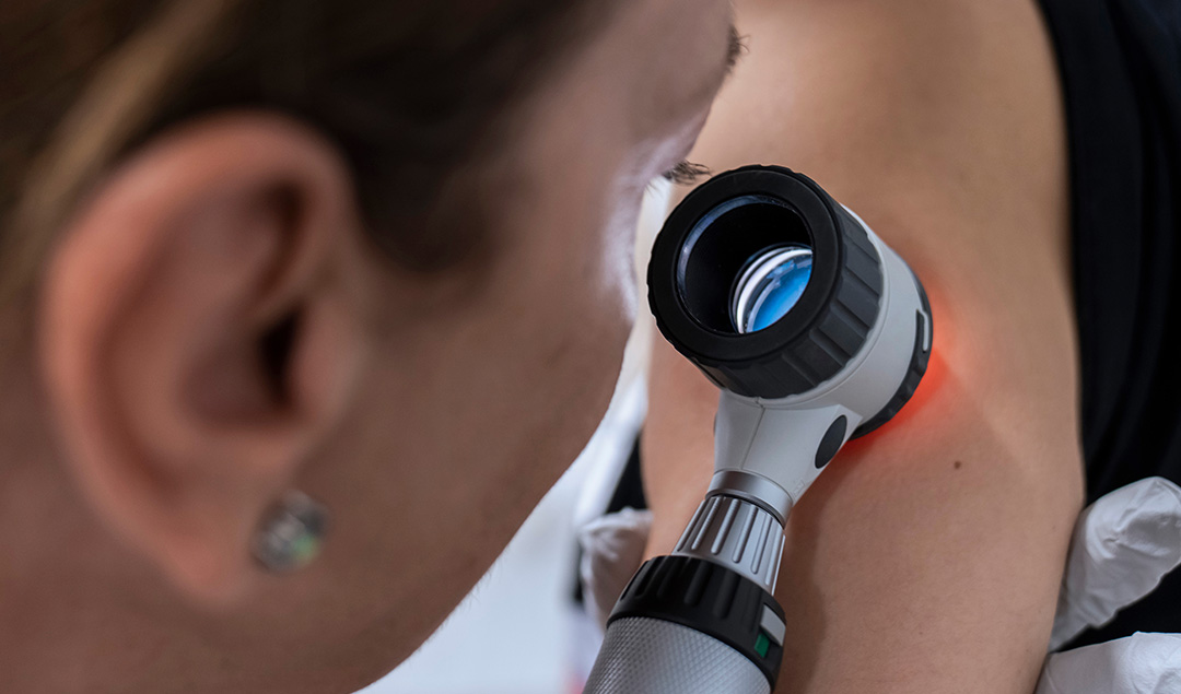 New Model System to Evaluate Subcutaneous Drug Absorption