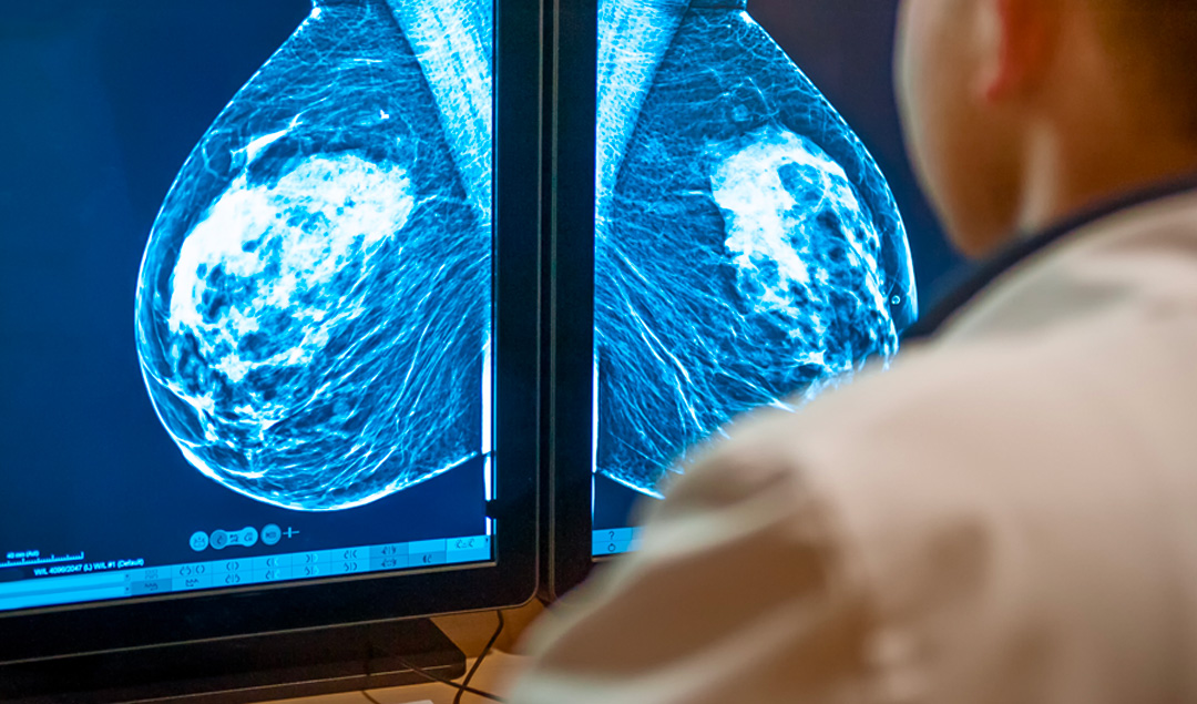 Development of a 3D Perfusion Platform for Breast Cancer Drug Testing